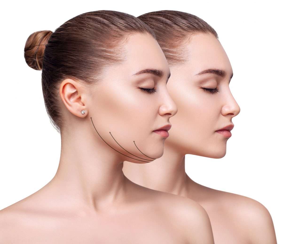 Is chin contouring the new cheek sculpt? - Hansplace